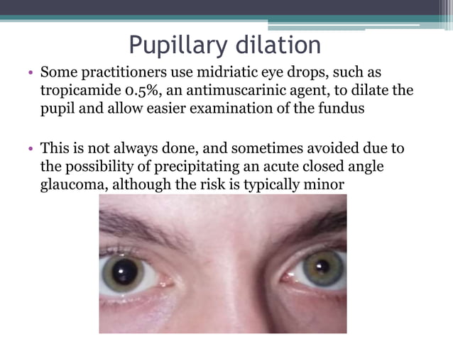 Direct Ophthalmoscopy/Fundoscopy | PPT