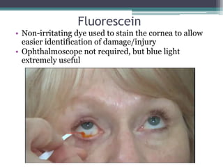 Direct Ophthalmoscopy/Fundoscopy | PPT