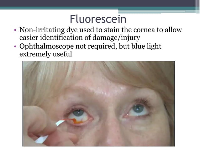 Direct Ophthalmoscopy/Fundoscopy | PPT