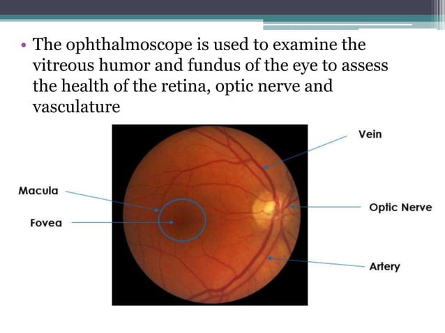 Direct Ophthalmoscopy/Fundoscopy | PPT