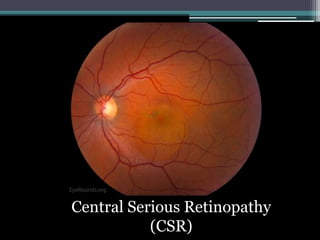 Direct Ophthalmoscopy/Fundoscopy | PPT