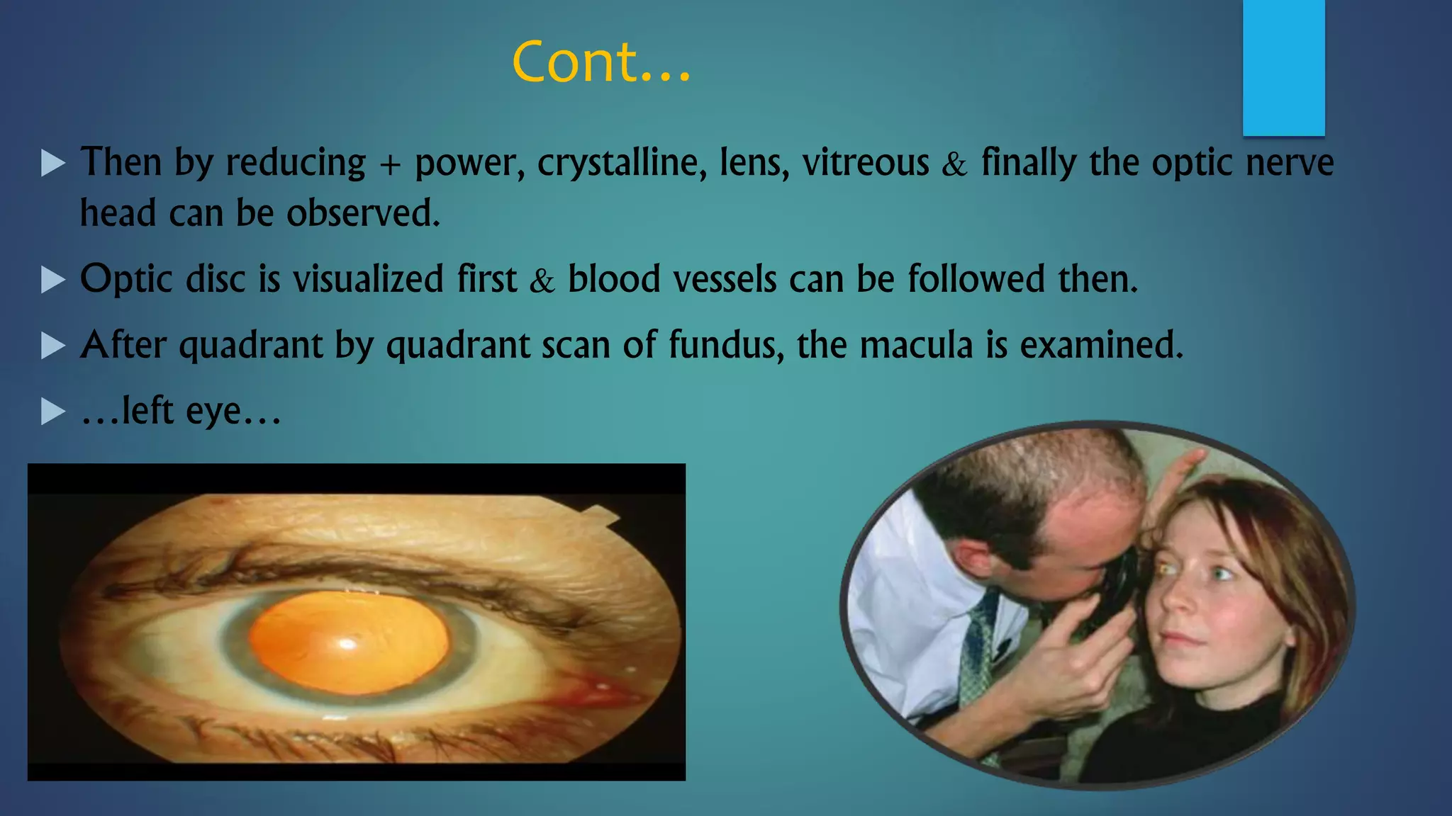 Direct ophthalmoscopy final | PPTX