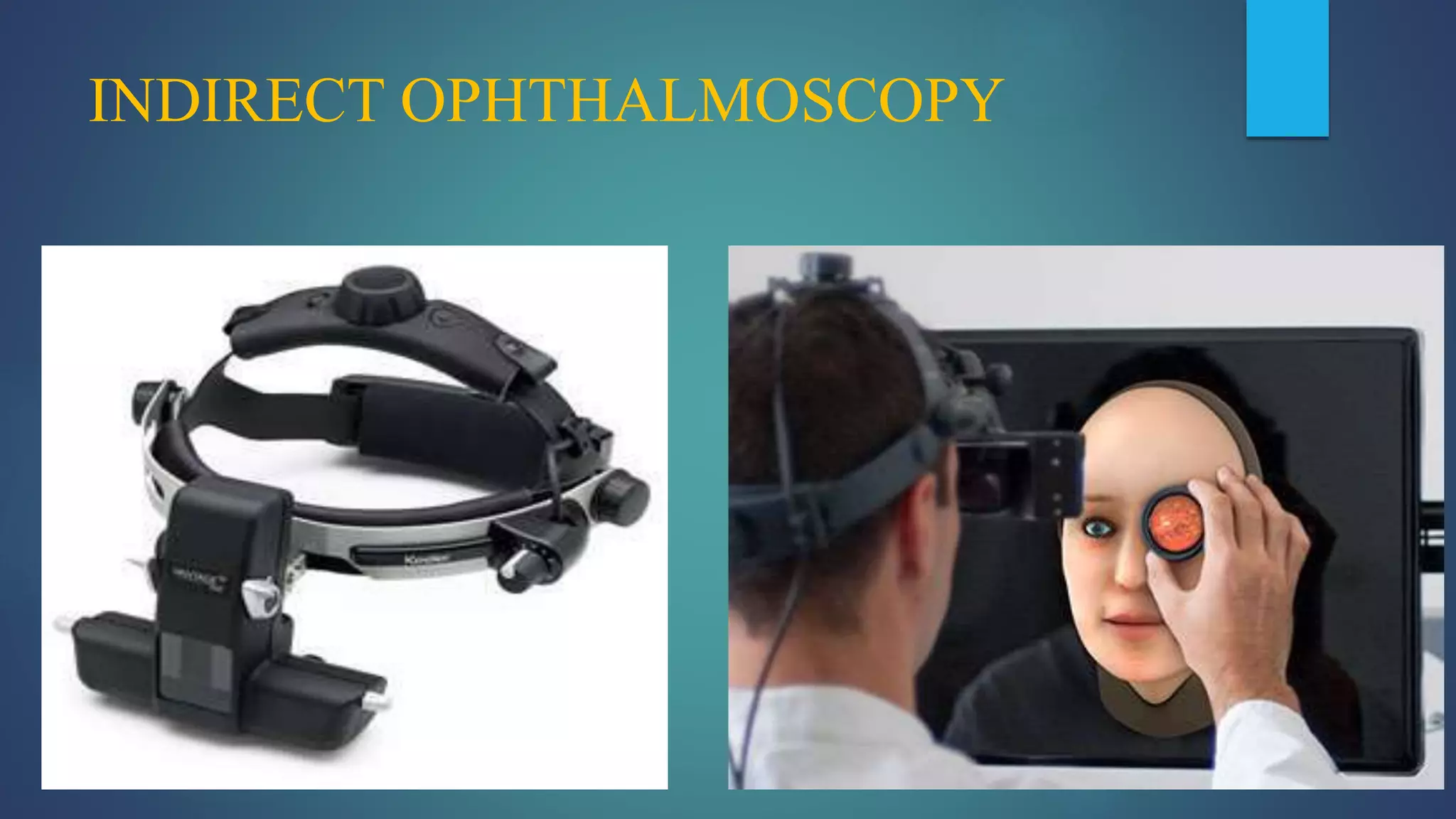 Direct ophthalmoscopy final | PPTX