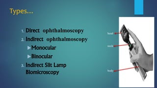 Direct ophthalmoscopy final | PPTX
