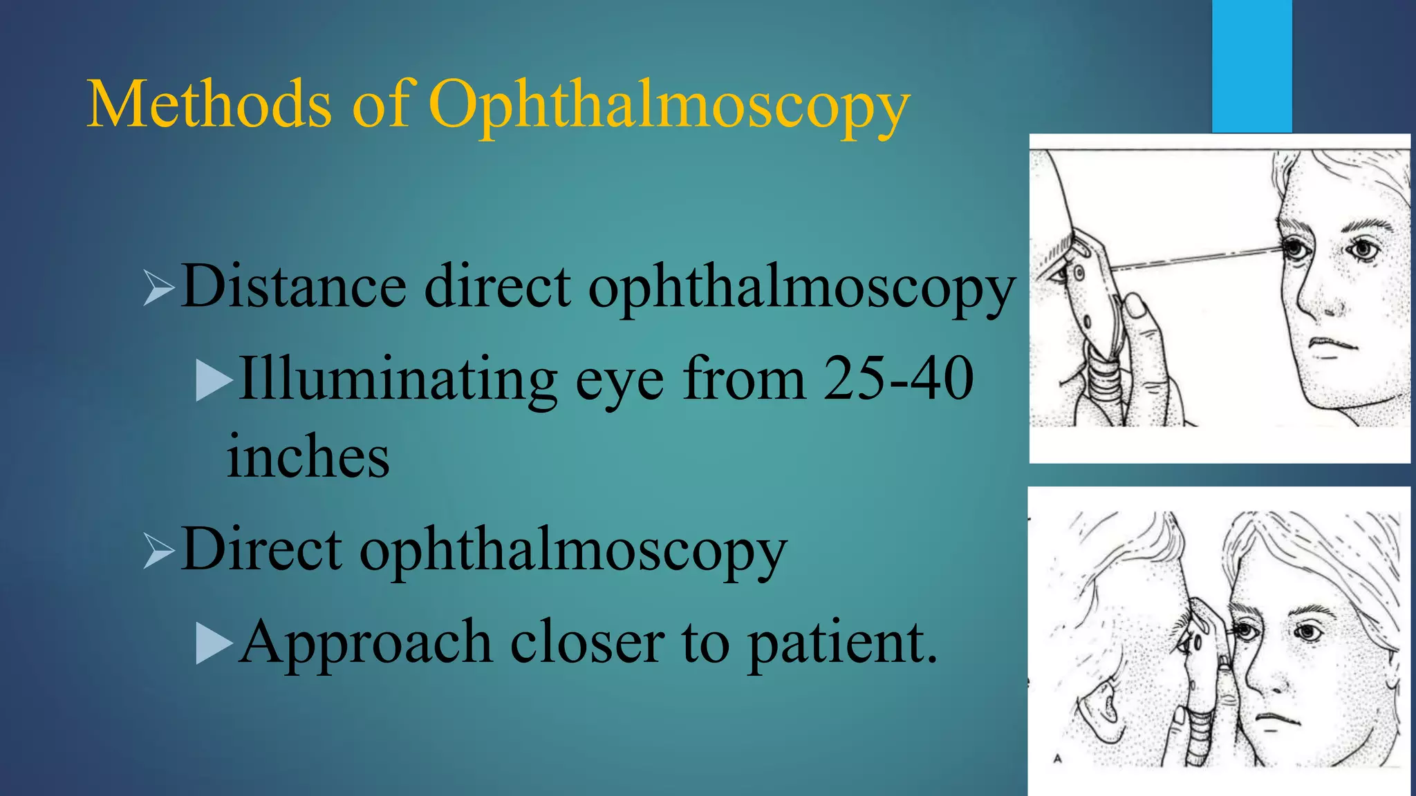 Direct ophthalmoscopy final | PPTX | Eye and Vision Conditions ...
