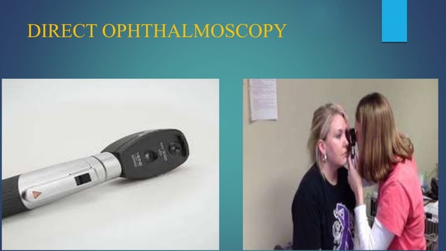 Direct ophthalmoscopy final | PPTX | Eye and Vision Conditions ...
