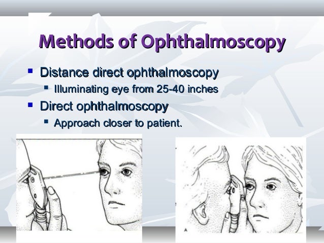 Direct opthalmoscopy~@Farhana.Islam