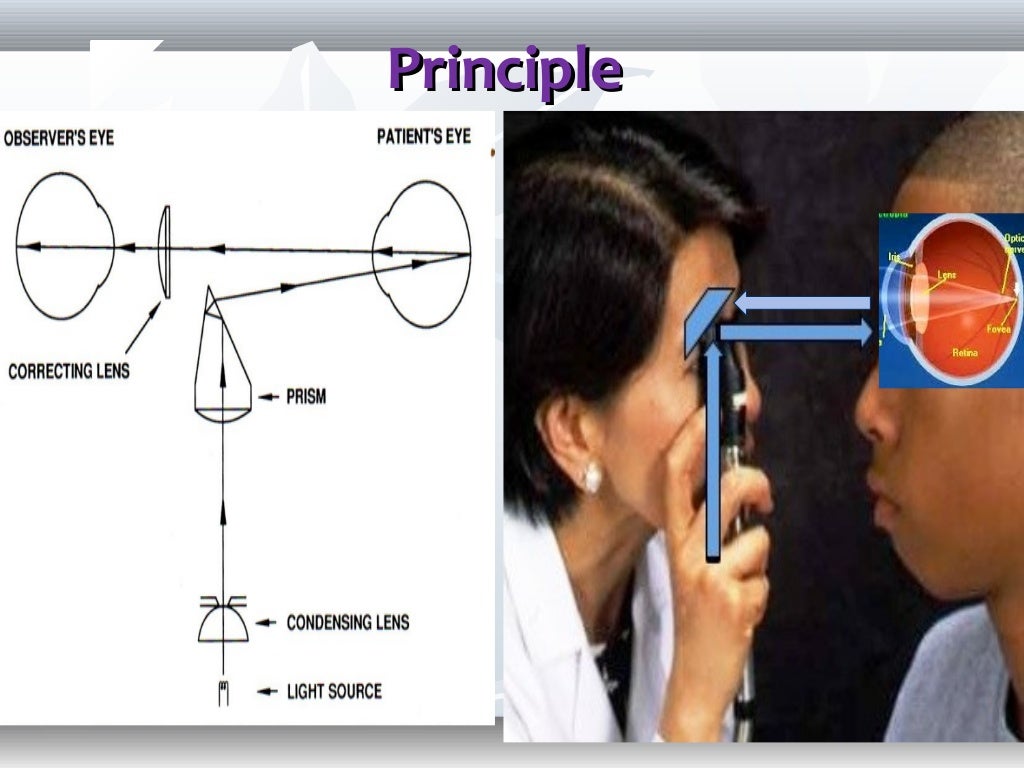 Direct opthalmoscopy~@Farhana.Islam