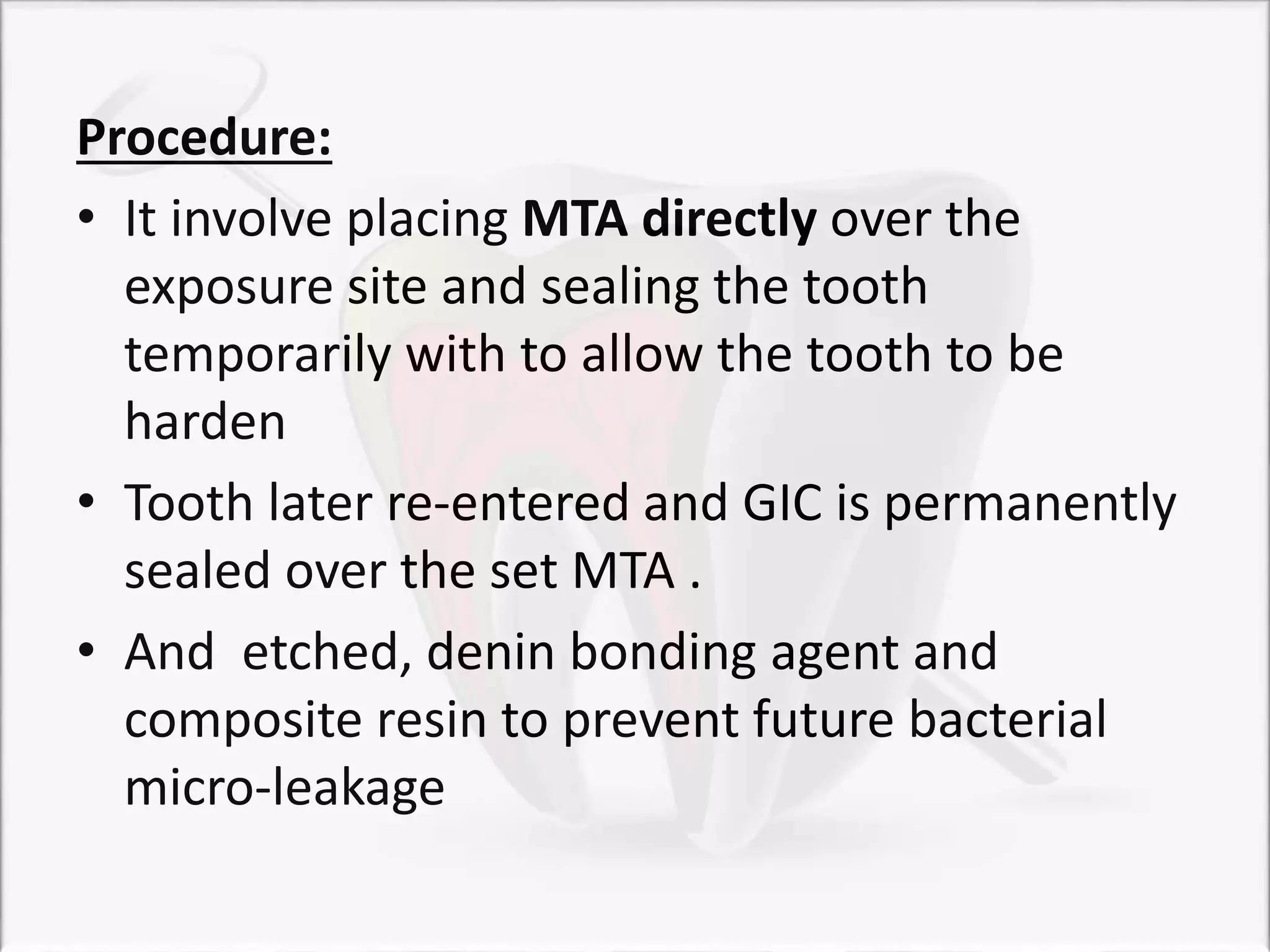 Direct pulp capping | PPTX