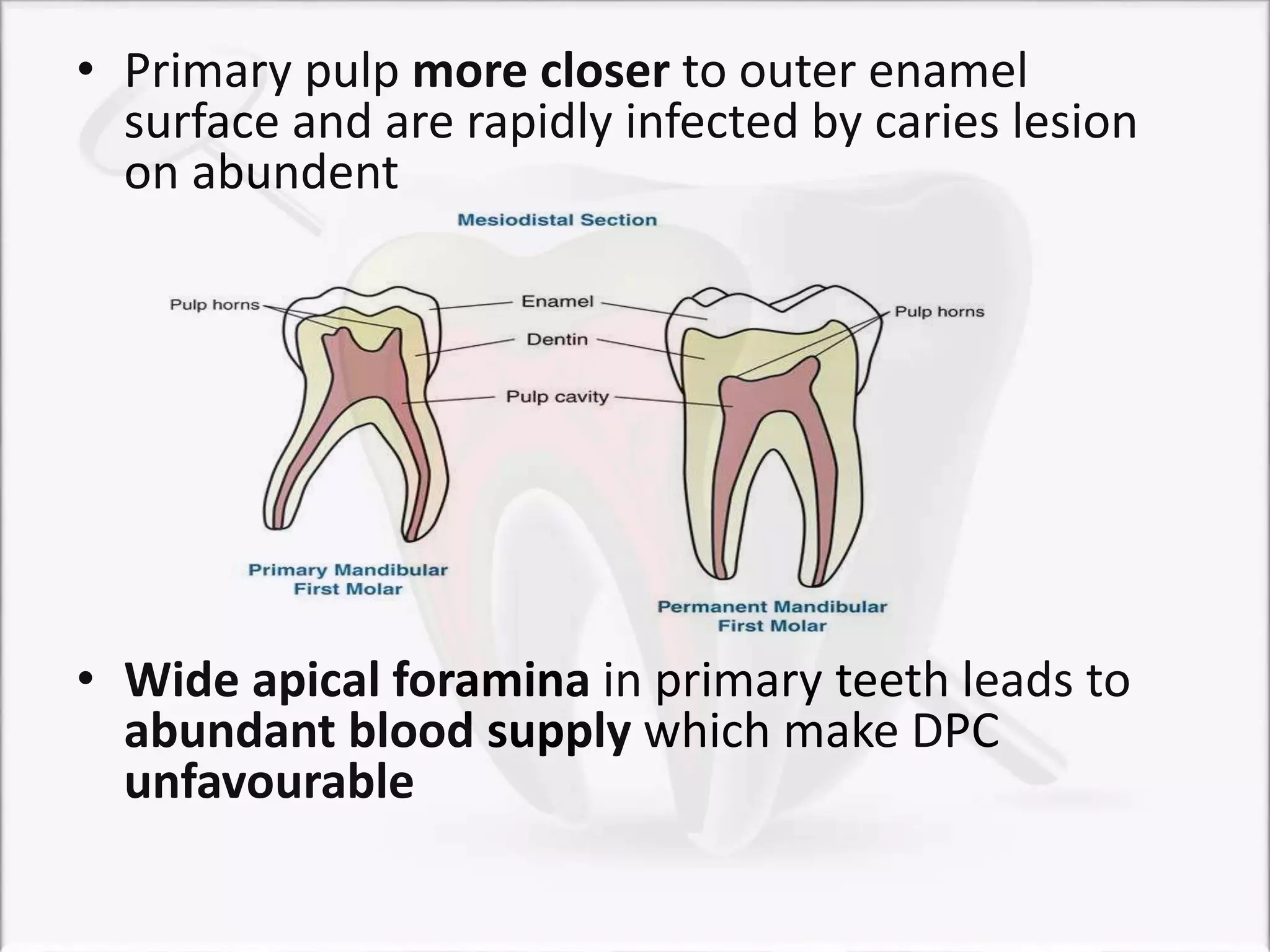 Direct pulp capping | PPTX