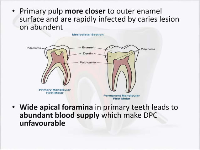 Direct pulp capping | PPTX | Dental Health | Diseases and Conditions