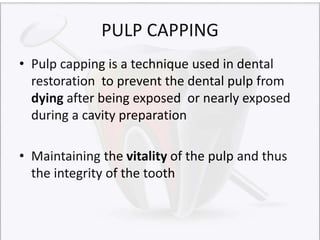 Direct pulp capping | PPTX