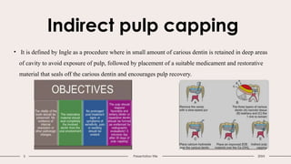 Direct pulp capping with PRF idm topic.pptx