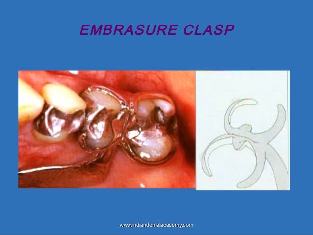 Direct retainer/ oral surgery courses