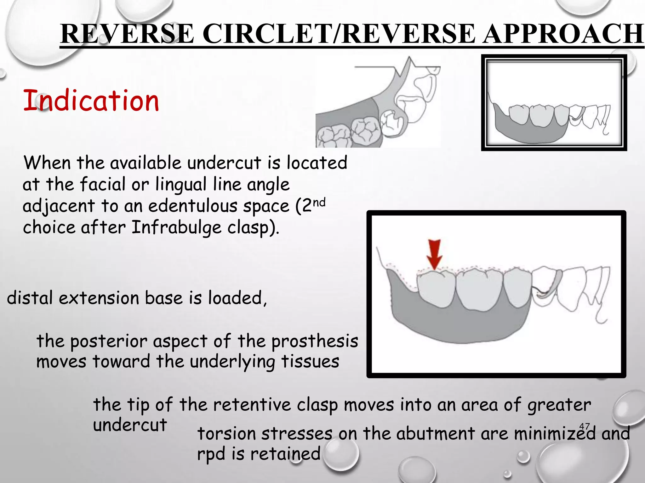 Direct retainer | PPTX