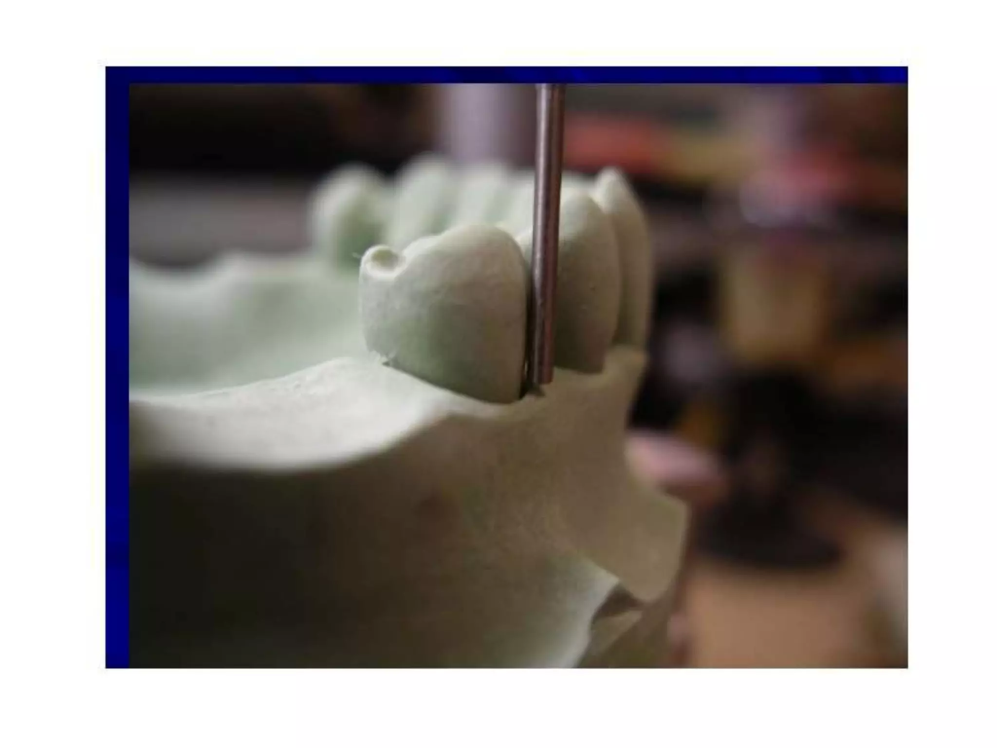 Direct retainer 2 | PPT
