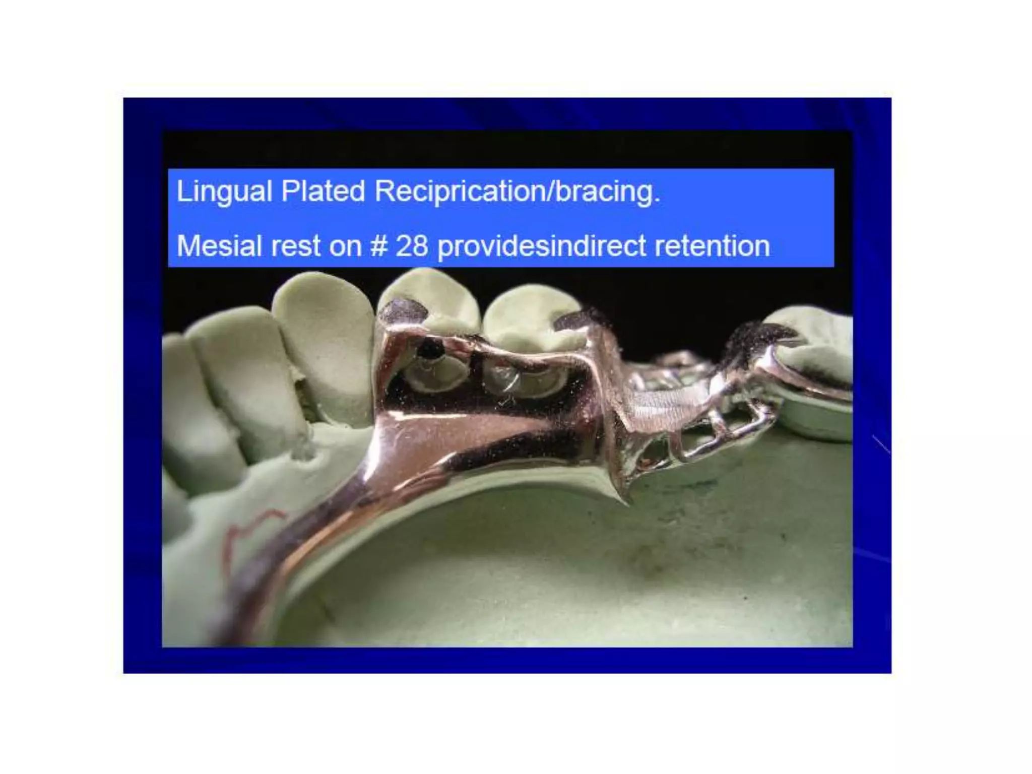 Direct retainer 2 | PPT