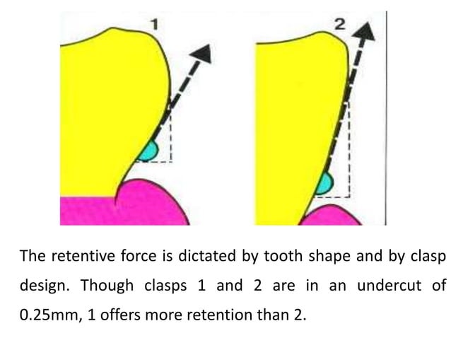 Direct retainer 2 | PPT