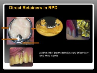 direct retainer in Cast partial Dentures.pptx