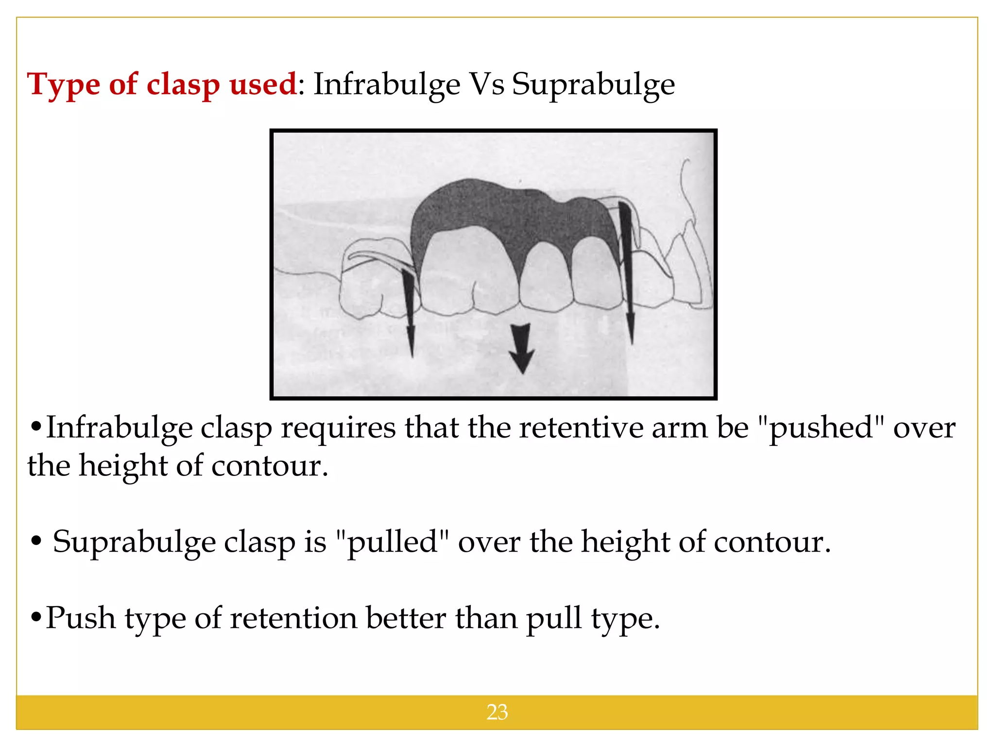 Direct retainers | PPTX