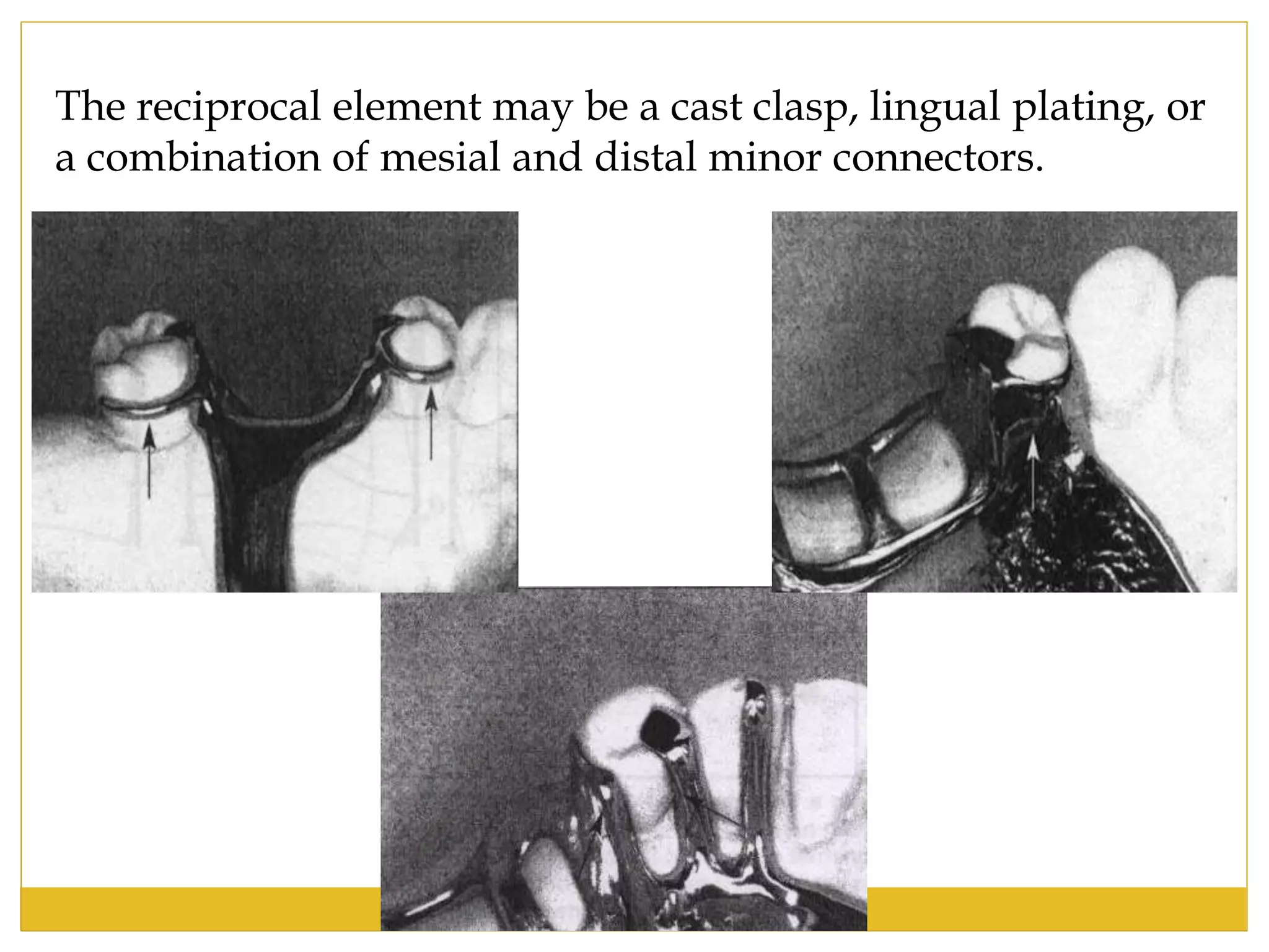 Direct retainers | PPTX