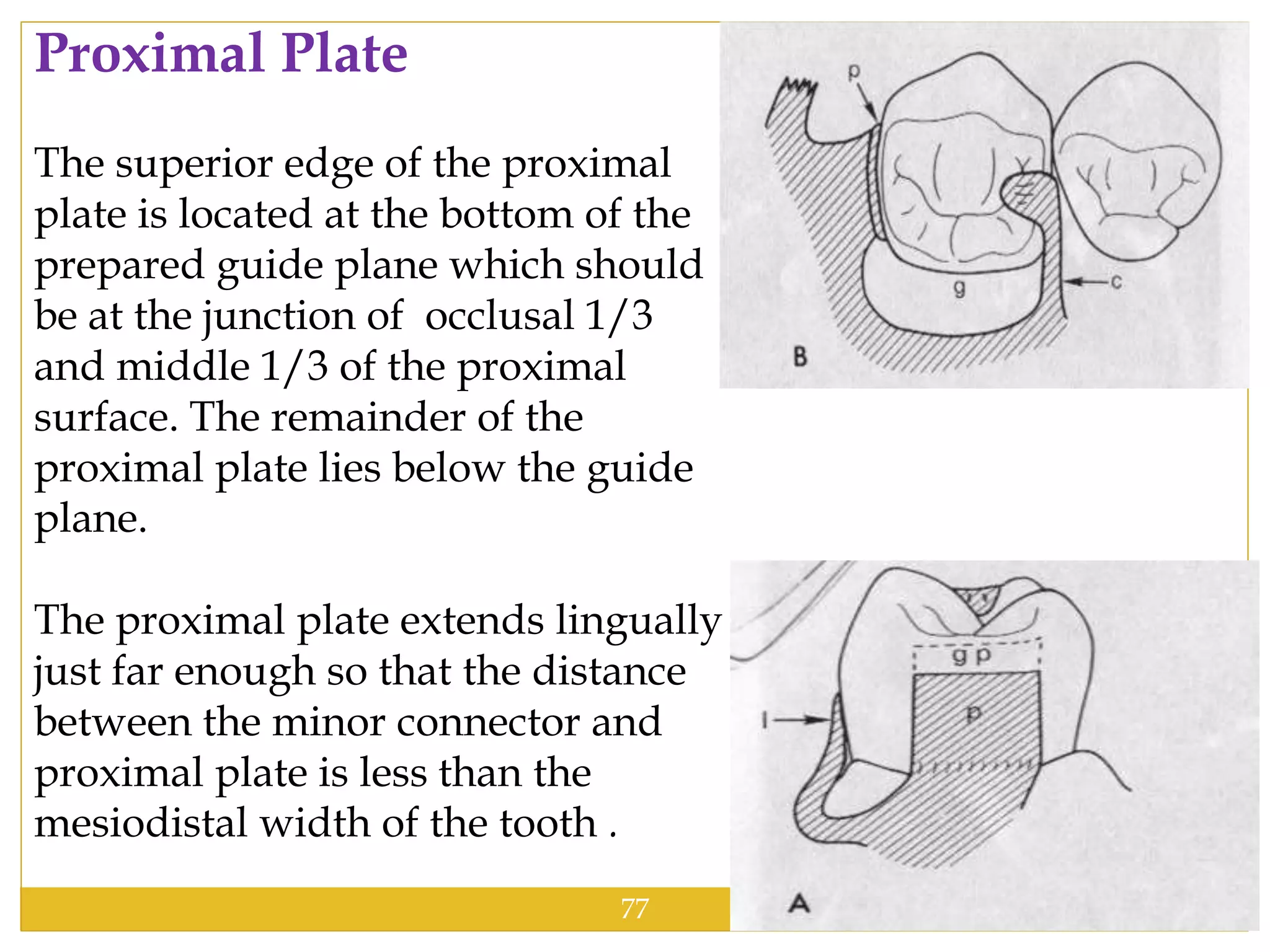 Direct retainers | PPTX