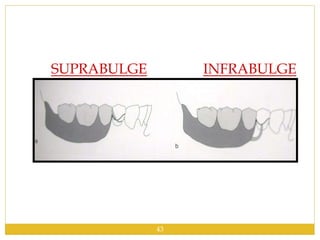 Direct retainers | PPTX