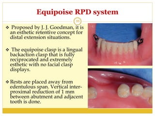 Direct retainers | PPTX