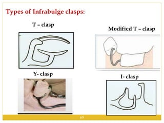 Direct retainers | PPT