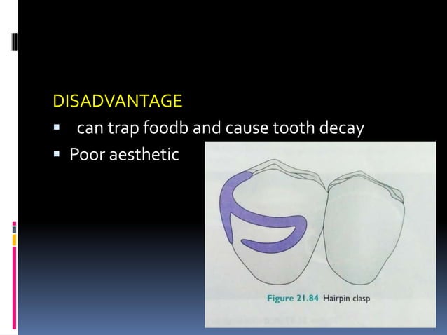 DIRECT RETAINERS.pptx | Dental Health | Diseases and Conditions