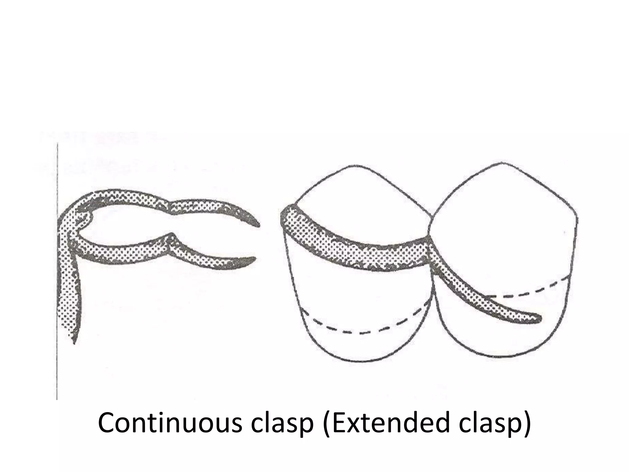 Direct retainers.pptx