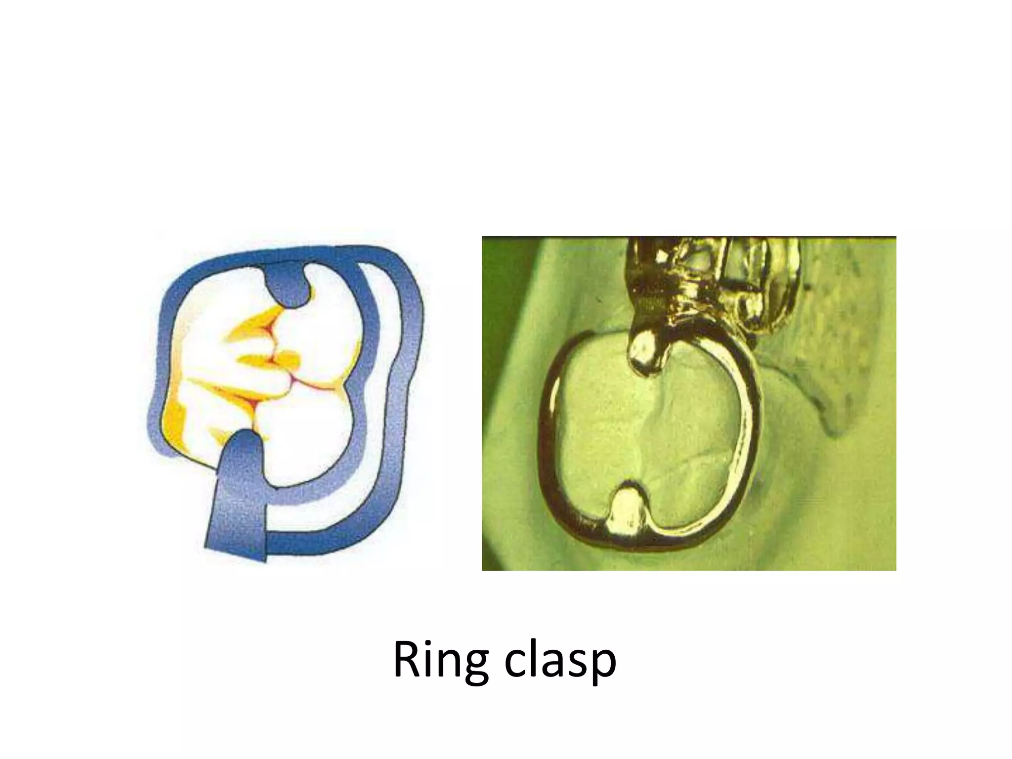 Direct retainers.pptx