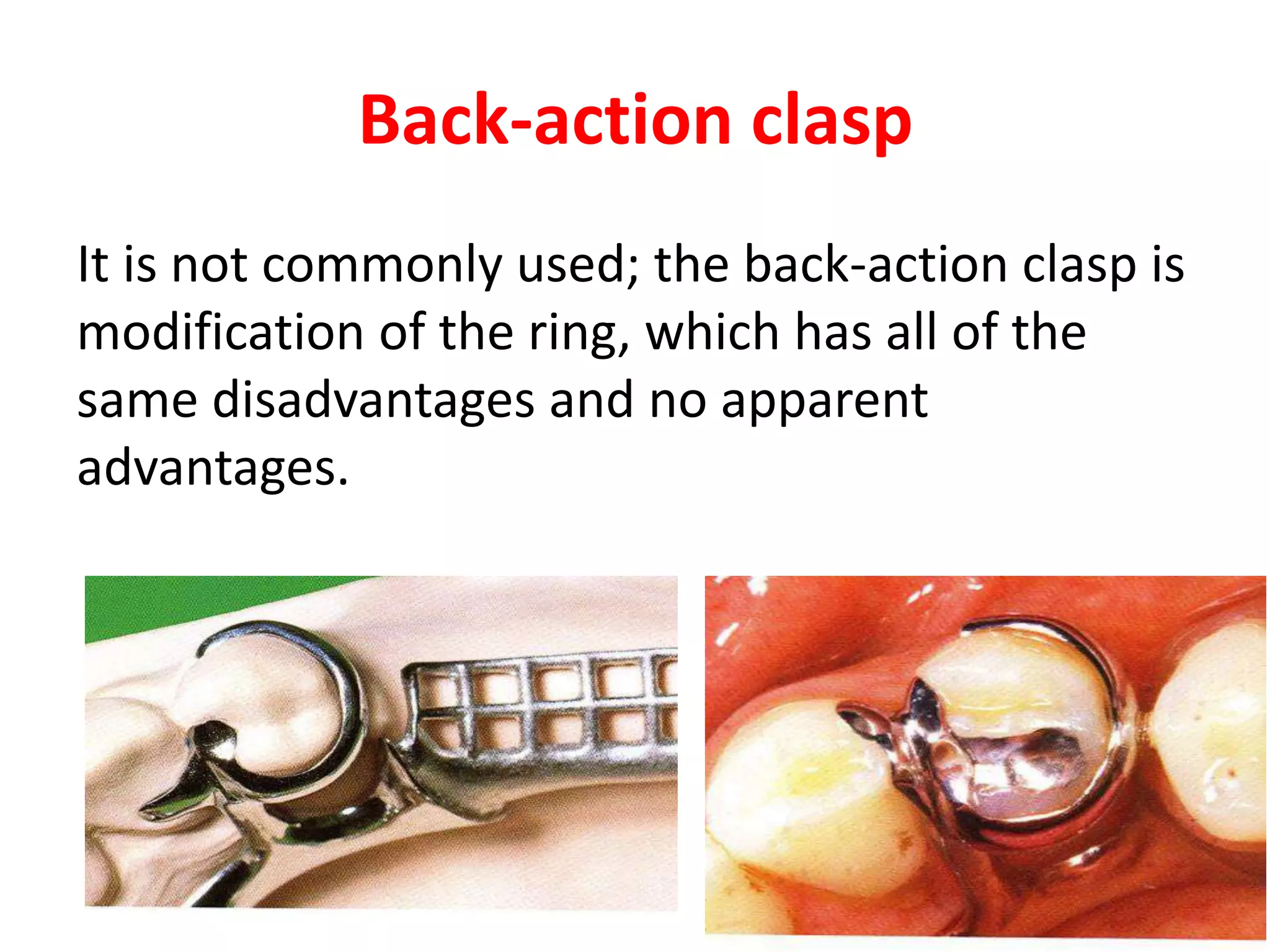 Direct retainers.pptx