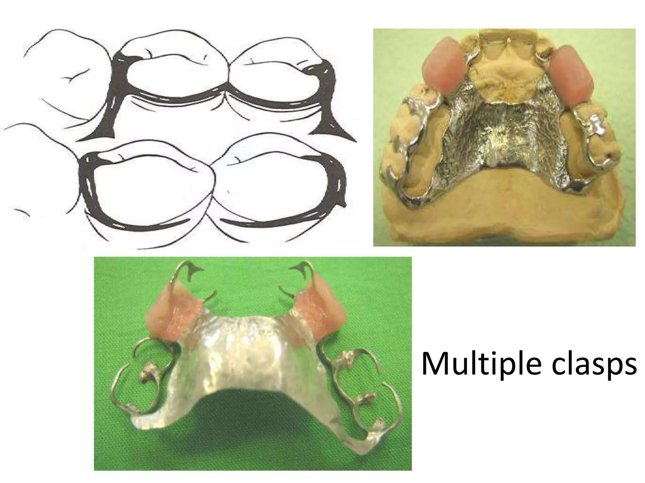 Direct retainers.pptx