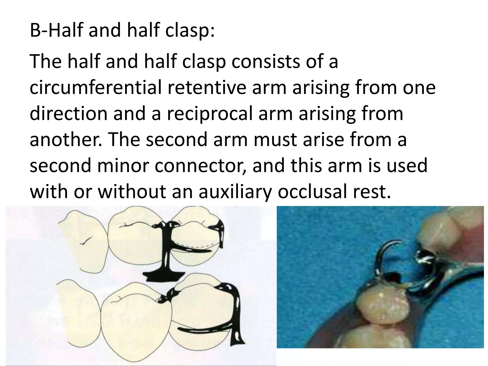 Direct retainers.pptx