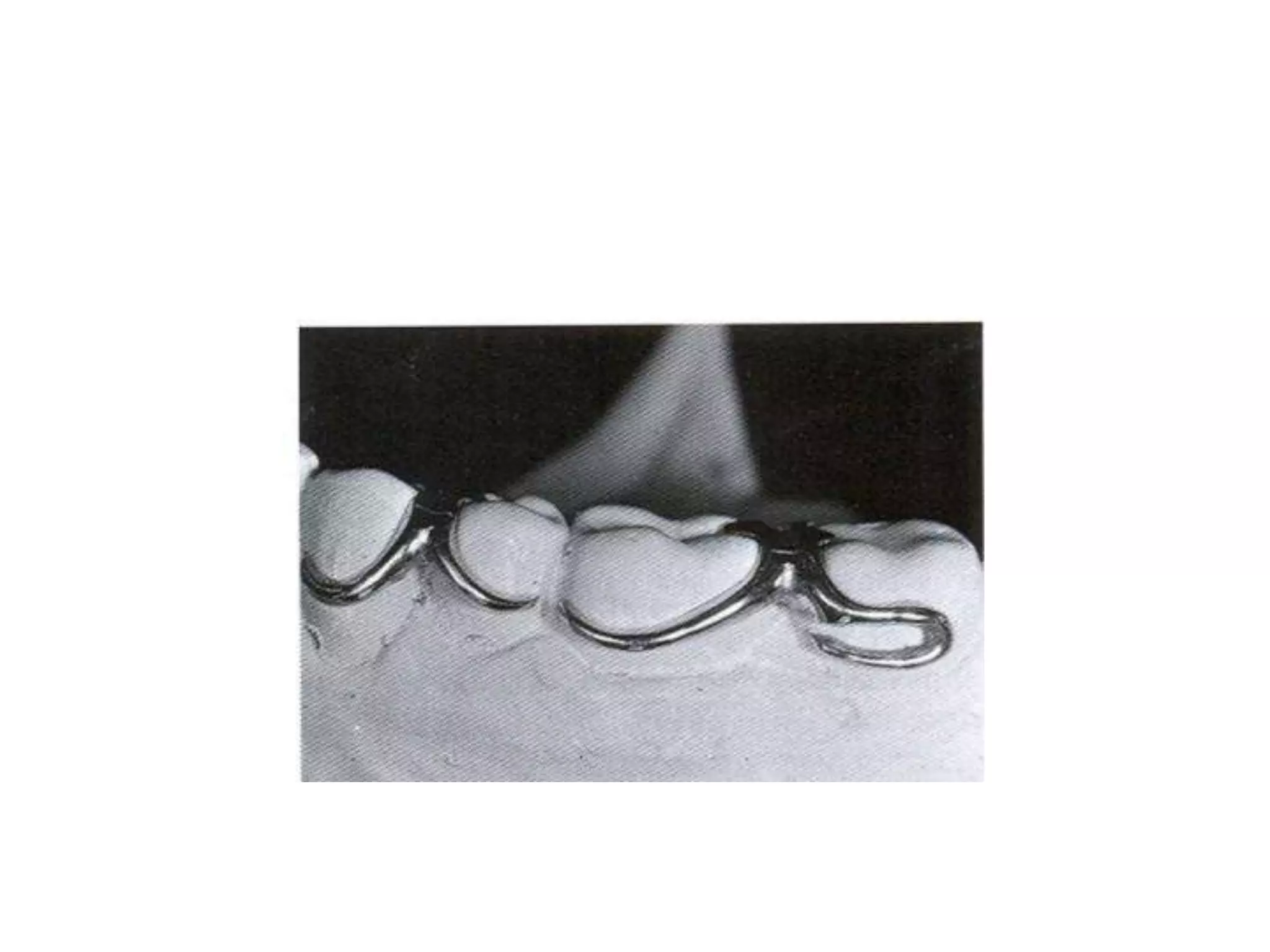 Direct retainers.pptx