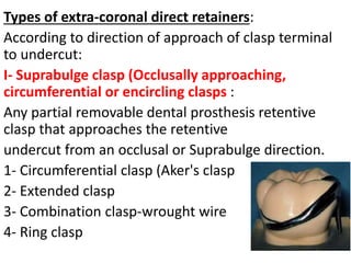 Direct retainers.pptx | Dental Health | Diseases and Conditions