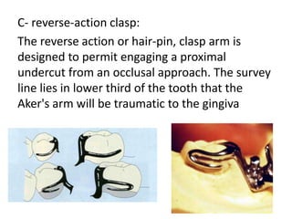 Direct retainers.pptx | Dental Health | Diseases and Conditions