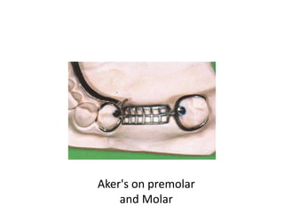 Direct retainers.pptx