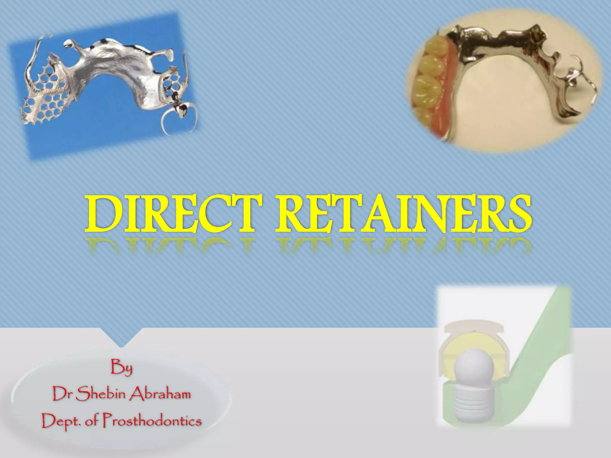 Direct retainers in removable partial dentures | PPTX