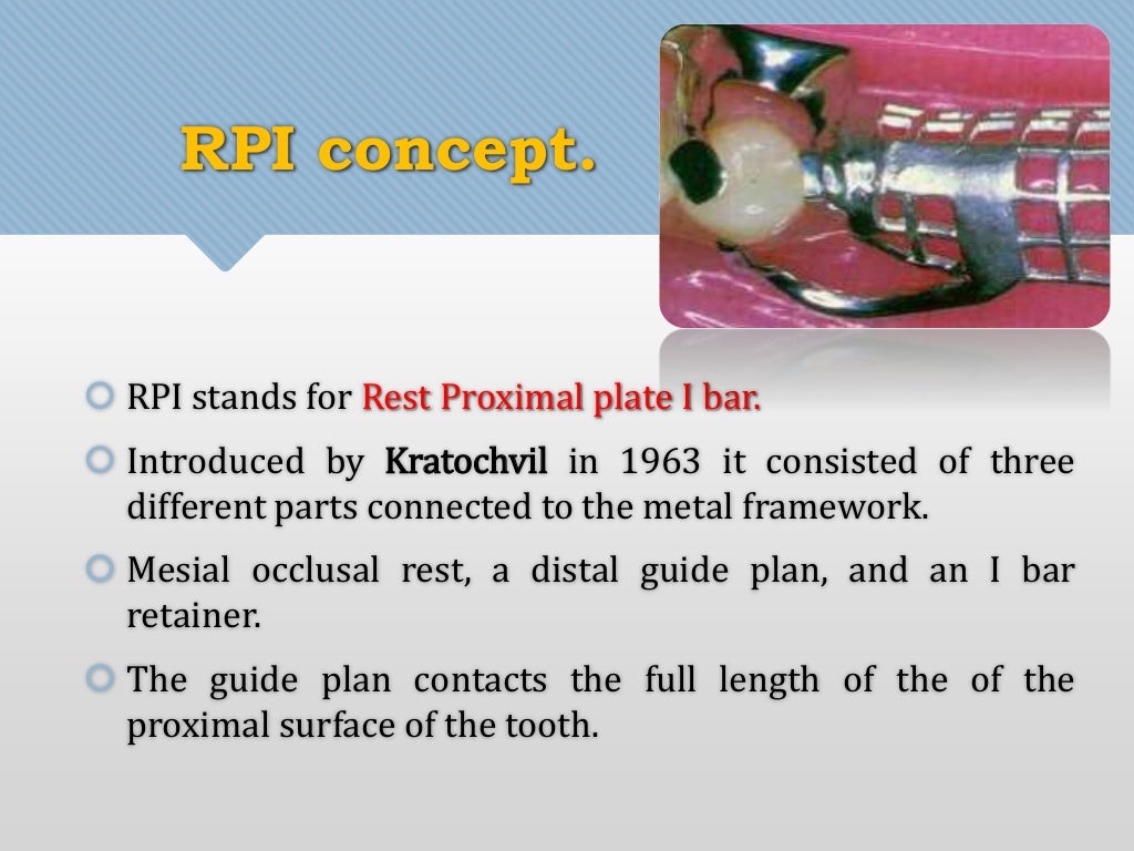 Direct retainers in removable partial dentures