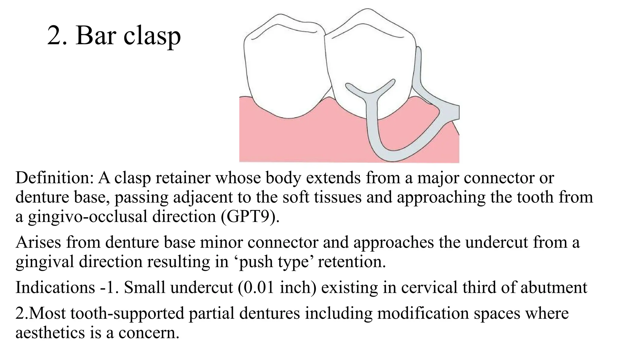 DIRECT RETAINERS IN REMOVABLE PARTIAL DENTURE | PPTX