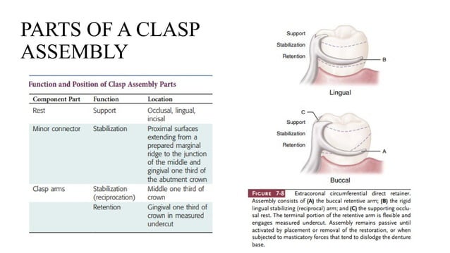 DIRECT RETAINERS IN REMOVABLE PARTIAL DENTURE | PPTX