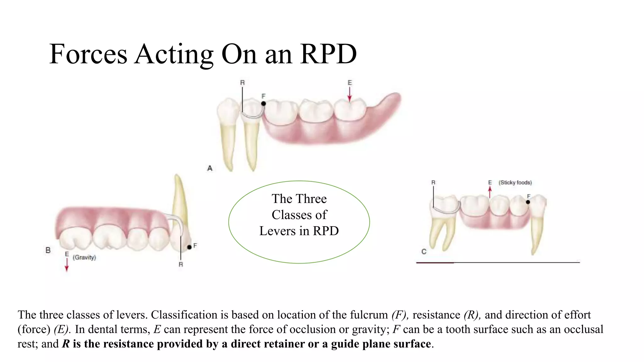 Direct retainers i | PPTX | Oral care | Personal Care