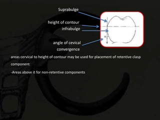 Direct Retainers in removable partial denture prosthodontics | PPTX