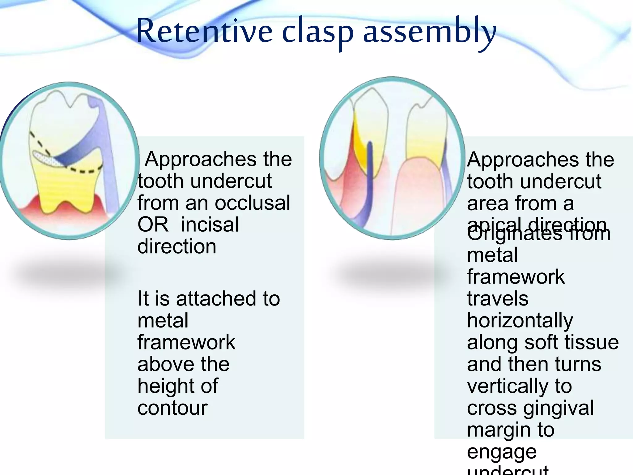 Direct retainers part i | PPTX