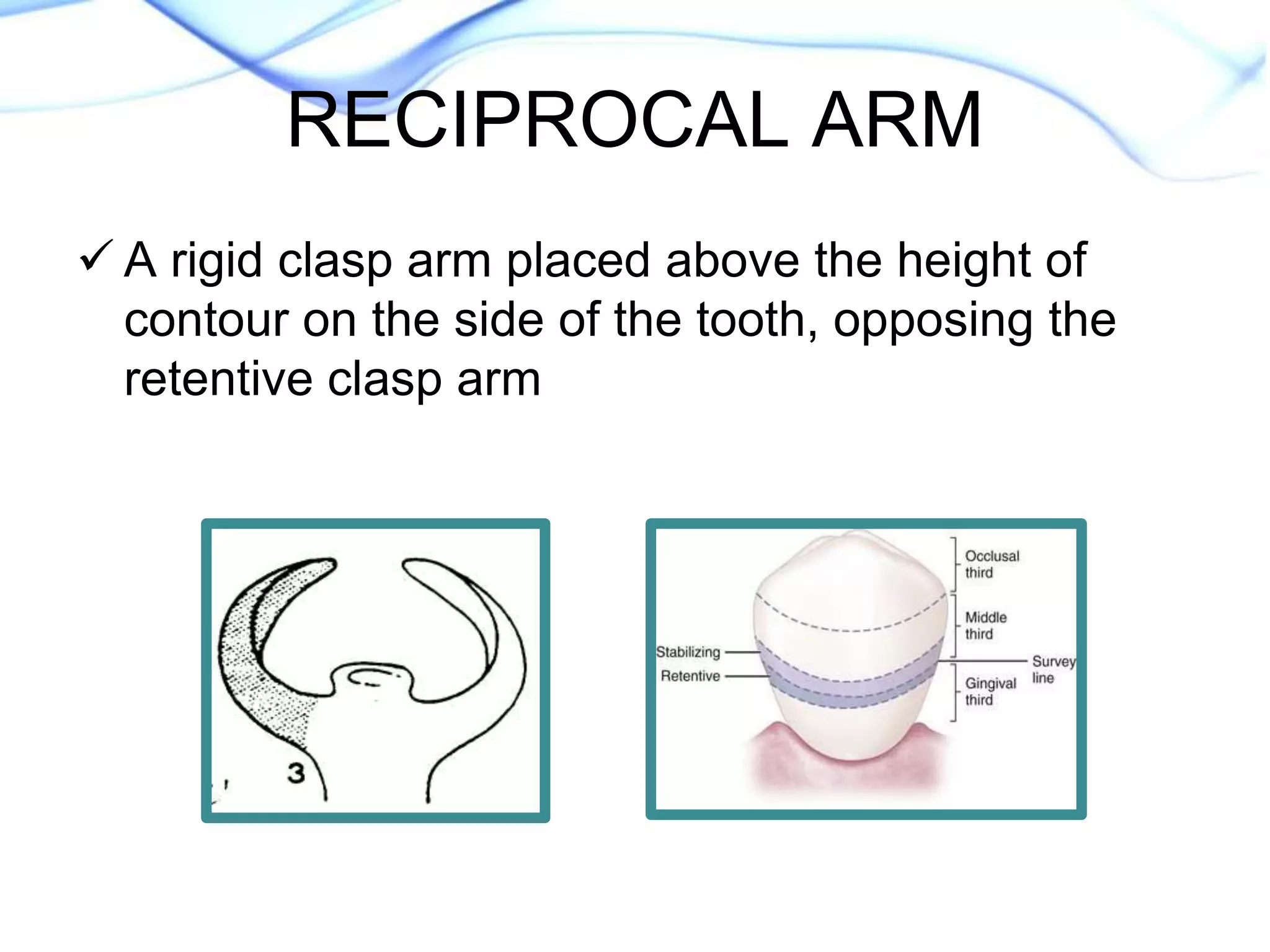 Direct retainers part i | PPTX