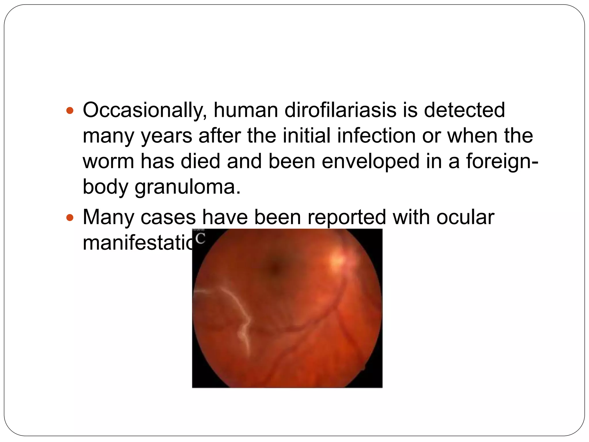 Dirofilariasis repens’ trapped in a radiologist | PPTX
