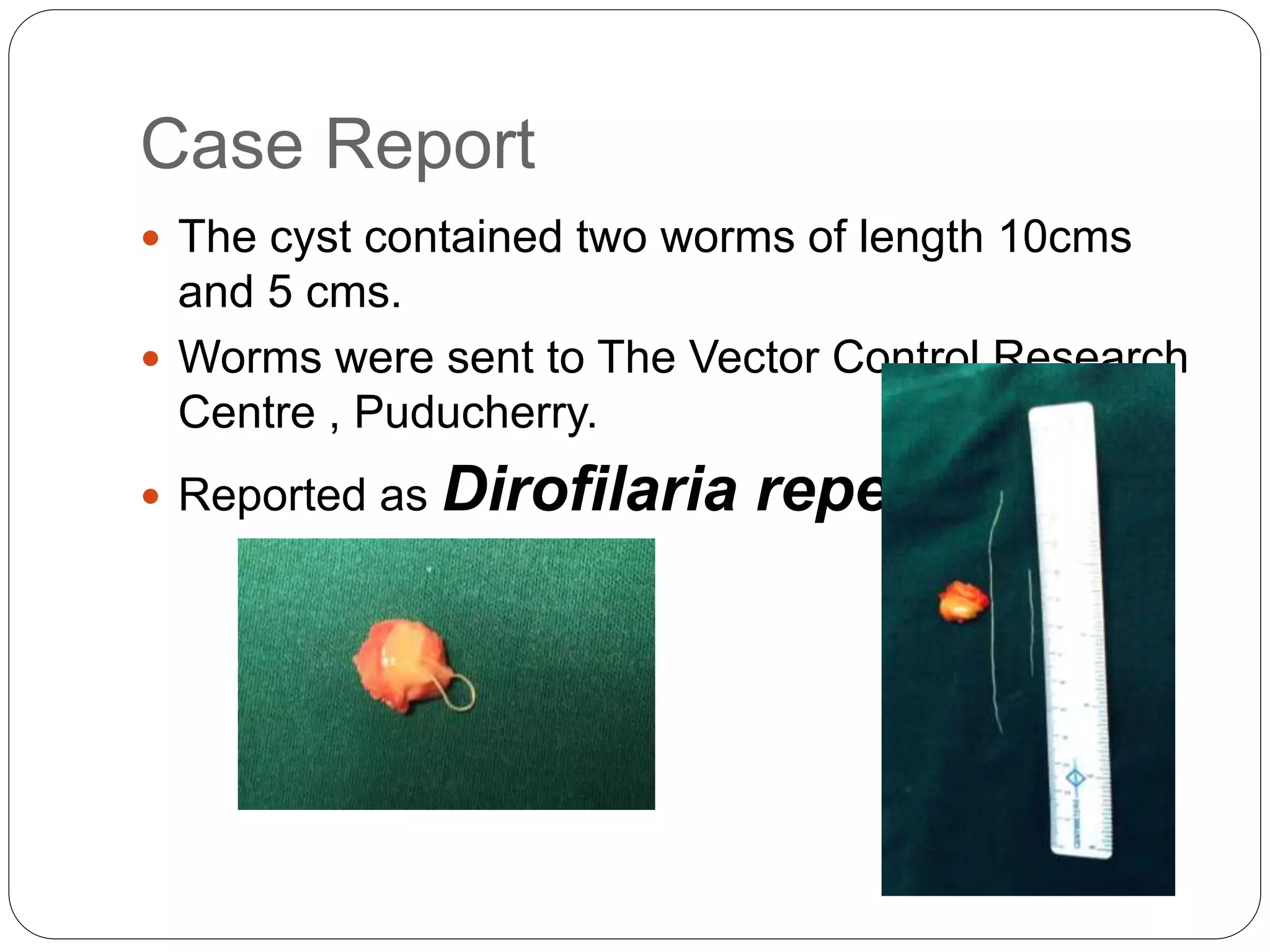 Dirofilariasis repens’ trapped in a radiologist | PPTX