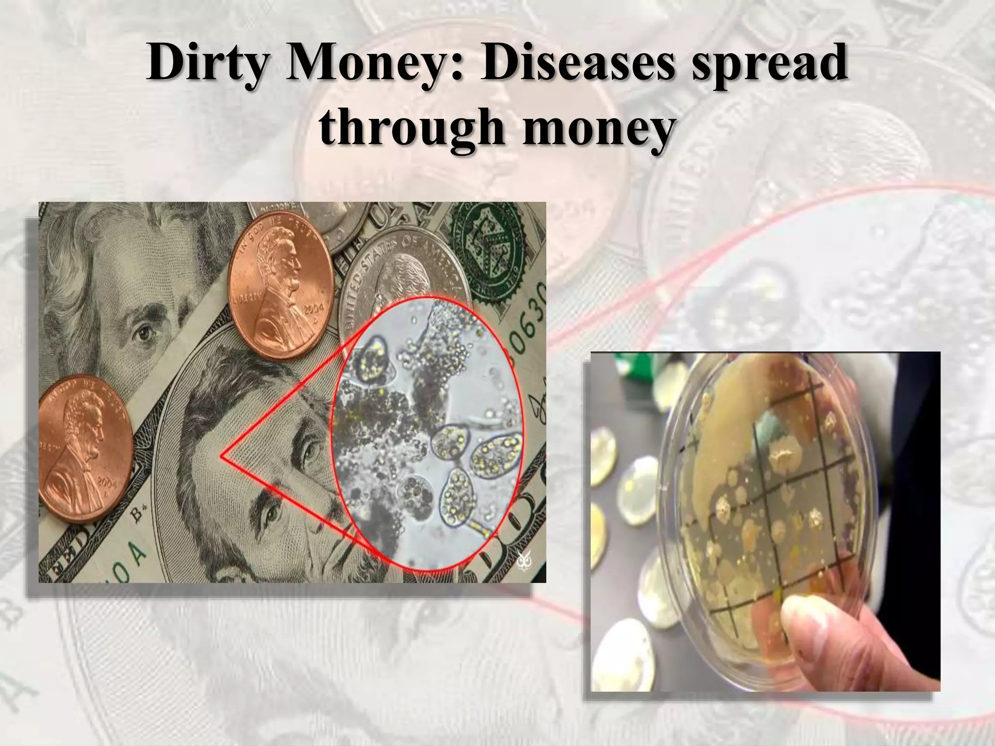 Dirty Money: Diseases spread through money (Currency notes) | PPTX